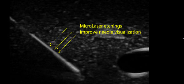 How to Buy an Ultrasound for Needle Guidance - Probo Medical FR
